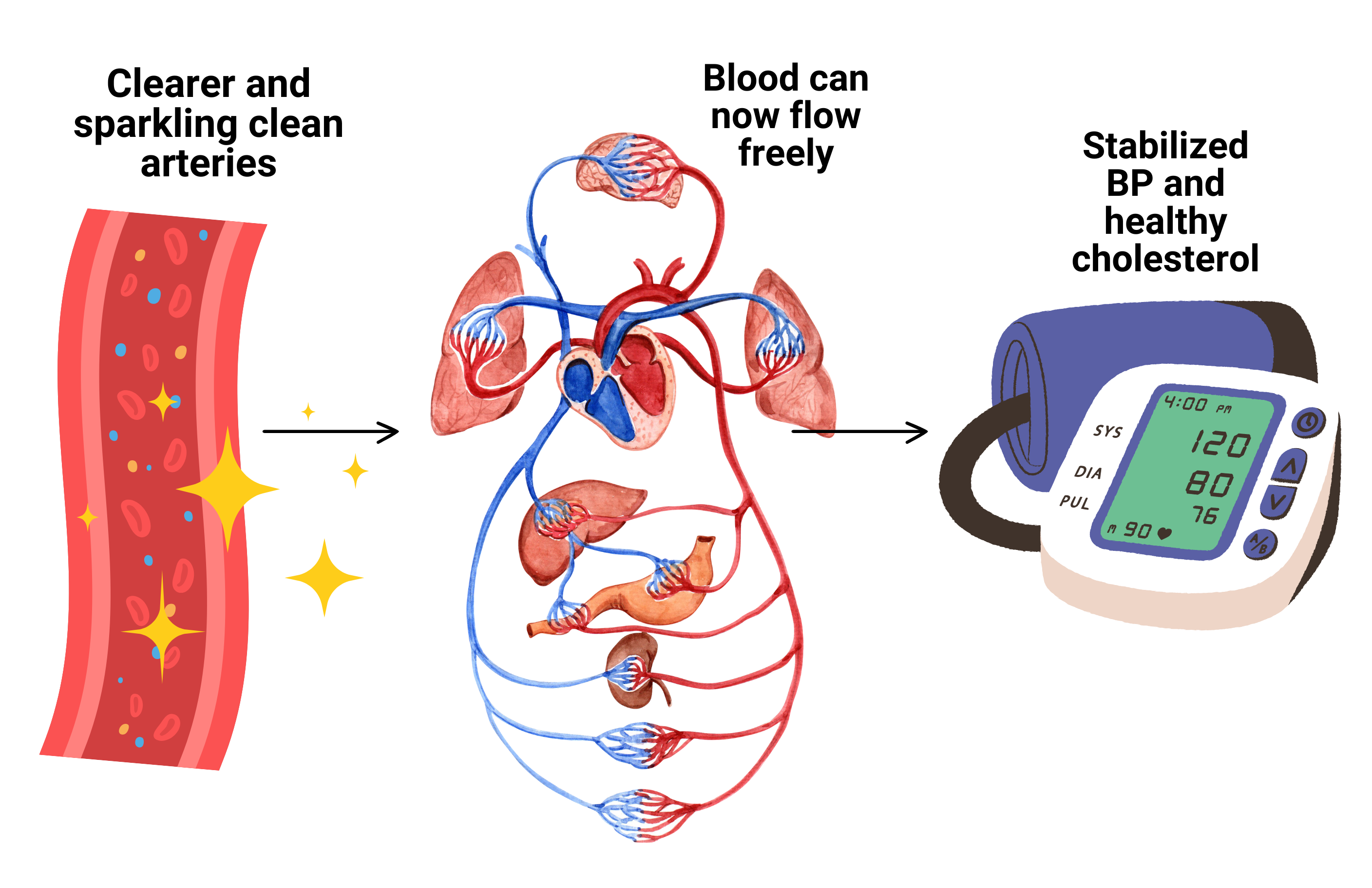 Don't Manage it, Reverse it!!!